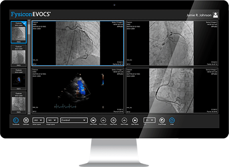 EVOCS - medische beelden en rapporten delen | Fysicon
